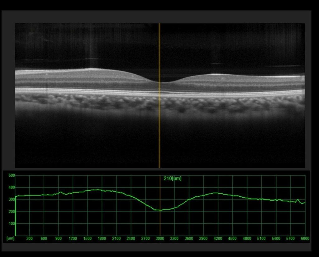 Pre-Screen Checks - Turners Opticians